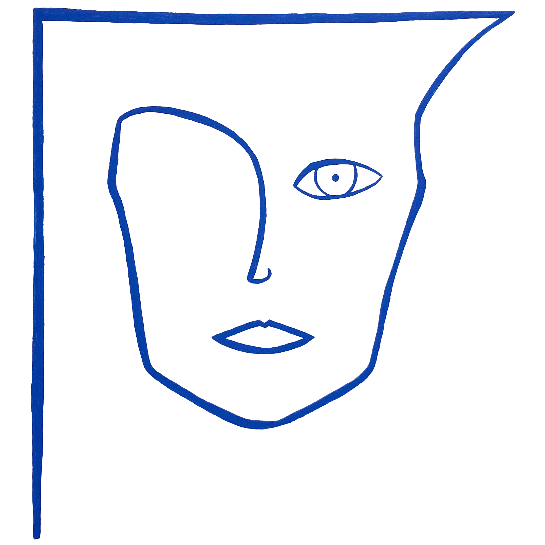 Surgical approach of ectopic maxillary third molar avulsion – Cabinet ...